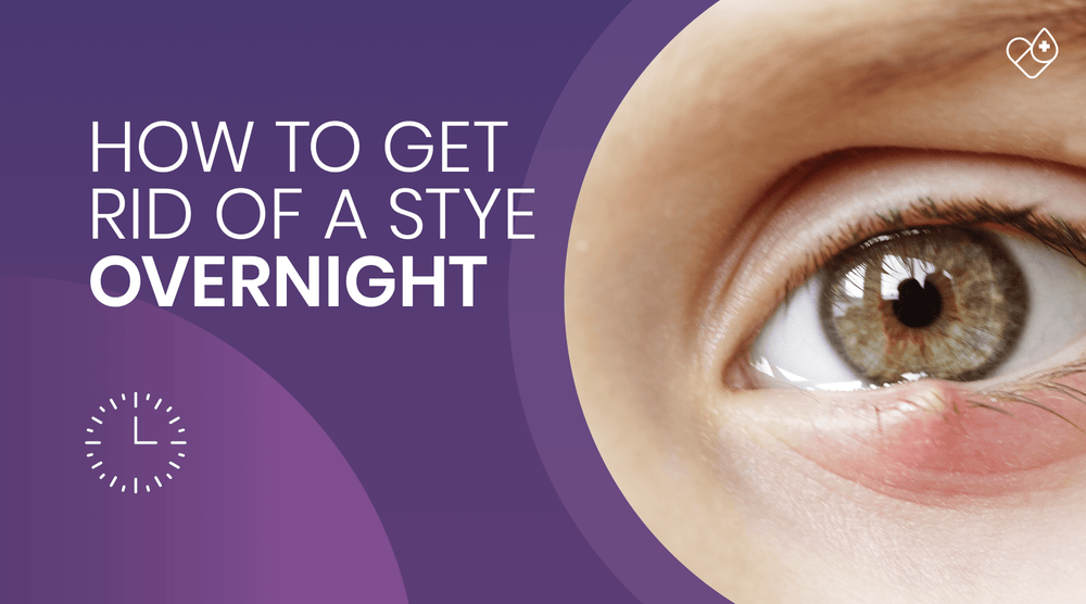How to get rid of a stye overnight – Dryeye Rescue